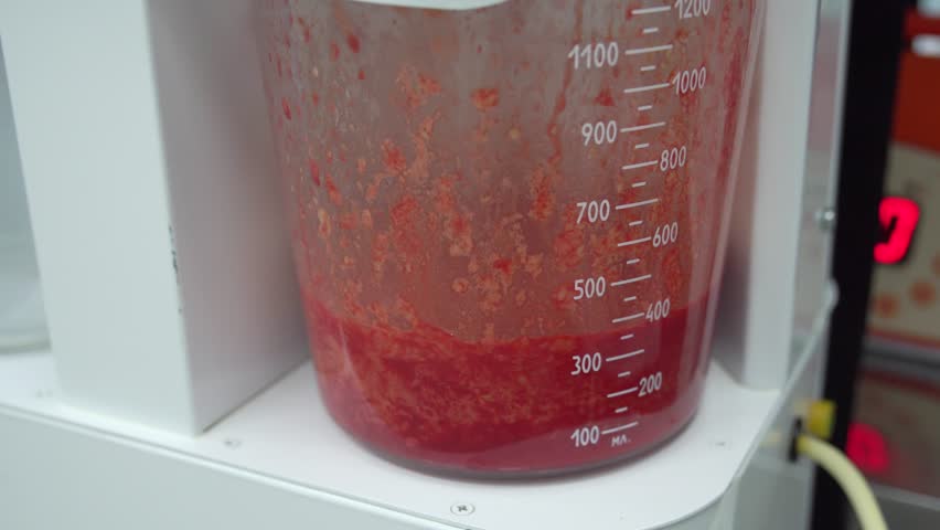 Fat Collecting Container for Liposuction Stock Footage Video (100% ...