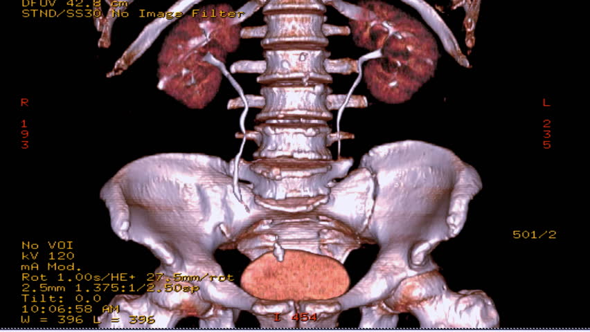 Ct Scan Urinary System Urography 3d Stok Videosu 100 Telifsiz 1019951629 Shutterstock