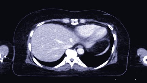 Ct scan leg Stock Video Footage - 4K and HD Video Clips | Shutterstock