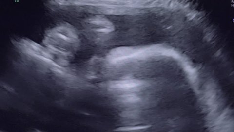 Scary Screaming Mummy Attacking Terrible Illustration Stock ...