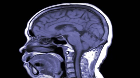 3d animation slow spinning transparent head Stock Footage Video (100% ...