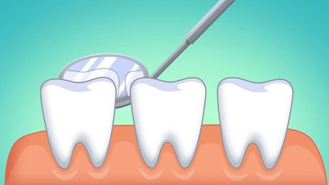 Human Teeth Vector Illustration Tooth: เวกเตอร์สต็อก (ปลอดค่าลิขสิทธิ์ ...