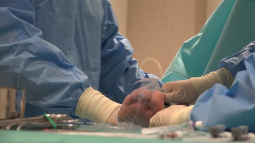 Endovenous Laser Ablation (evla) is Stock Footage Video (100% Royalty ...