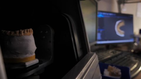 rectoscopy monitor screen close up examination Stock Footage Video (100 ...