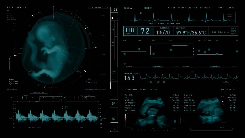 blue futuristic patient monitor screen perspective Stock Footage Video ...
