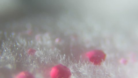 Mold Taken Rotten Currant Under Microscope Stock Footage Video (100% ...