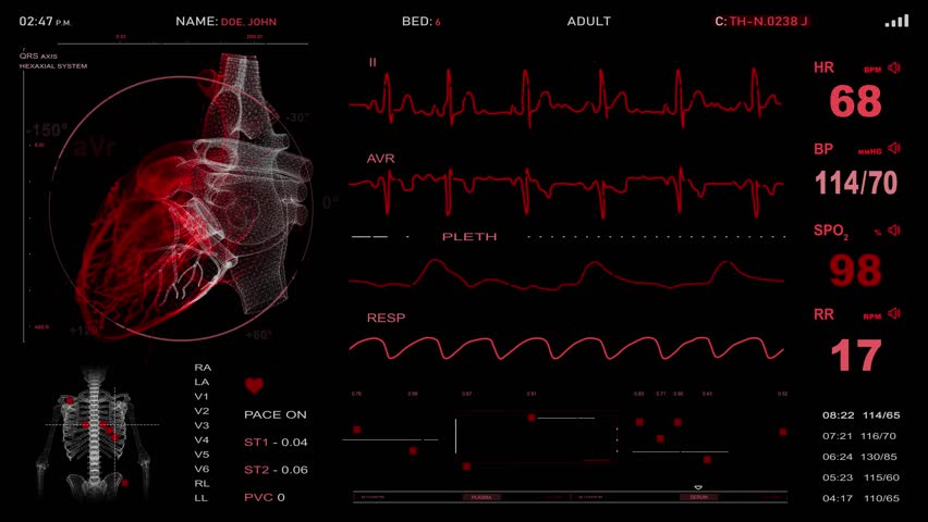 Cardiac Monitoring. Heart Monitor. Electrocardiography. Stock Footage ...