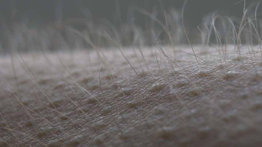 goosebumps close up hair on hand Stock Footage Video (100% Royalty-free ...