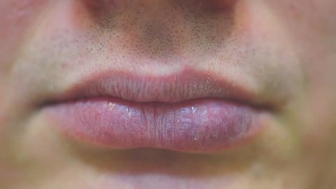 Whitish Discoloration Of Lips | Lipstutorial.org