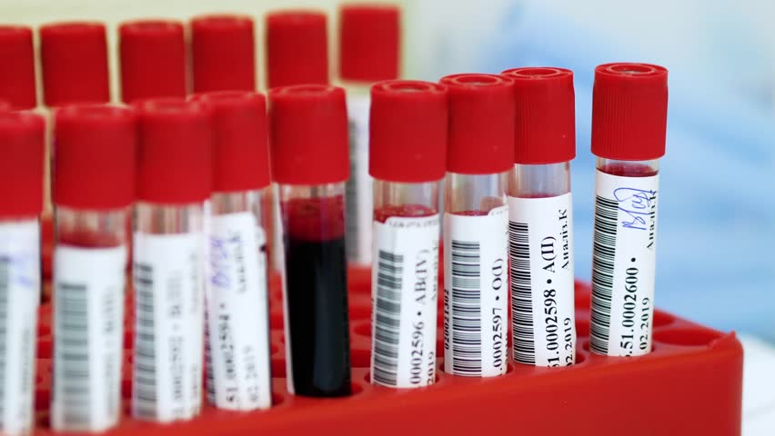 blood samples containers research special tray Stock Footage Video (100 ...