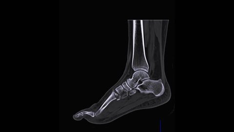 Ct scan leg Stock Video Footage - 4K and HD Video Clips | Shutterstock