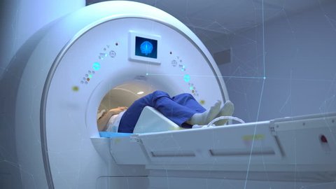 Scan Human Brain Using Xray Machine Stock Footage Video (100% Royalty ...