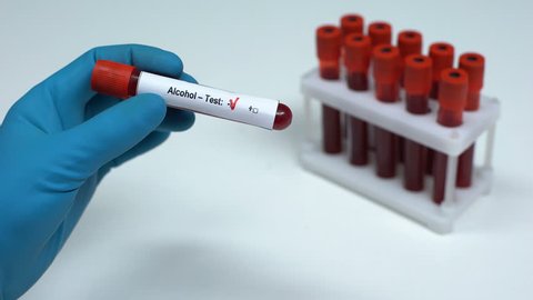 Red Blood Cells Flowing Through Capillary Stock Illustration 1236116818 ...