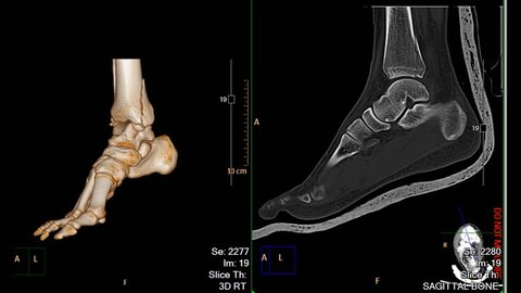 Ct scan leg Stock Video Footage - 4K and HD Video Clips | Shutterstock