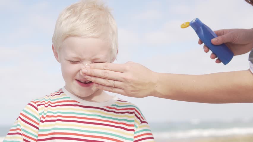 mom smears face albino boy sunburn Stock Footage Video (100% Royalty ...