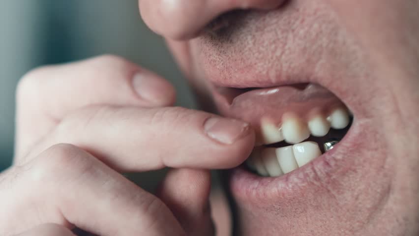 mouth elderly man false teeth older Stock Footage Video (100% Royalty ...