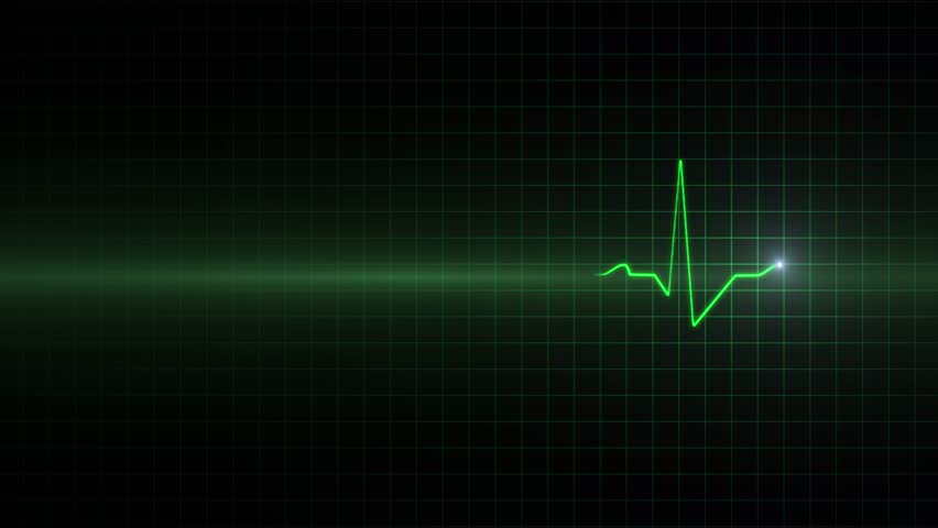 Animated Ekg Heart Monitor Display Stockvideoklipp (helt royaltyfria ...