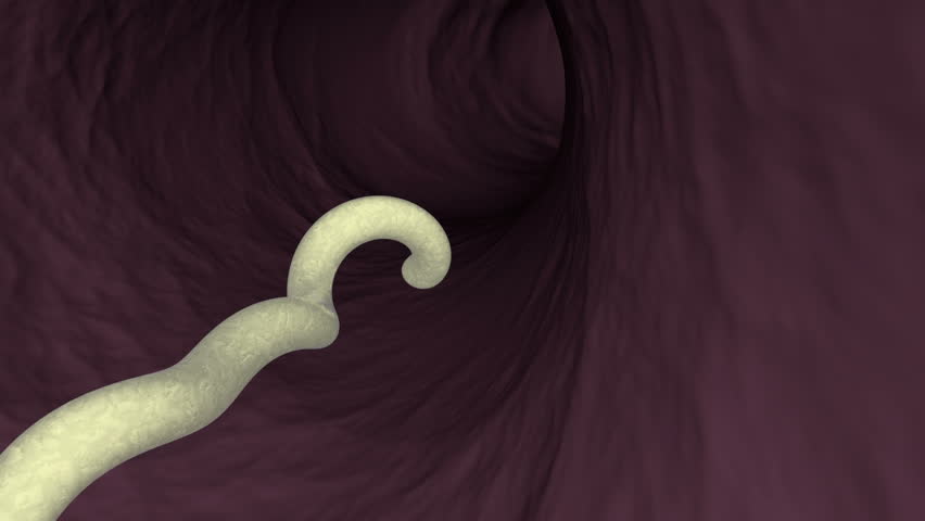 129 Pinworm Stock Video Footage - 4K and HD Video Clips | Shutterstock