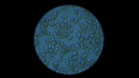 Vegetable Stool Analysis Under Microscope Stock Photo (Edit Now) 1923060653