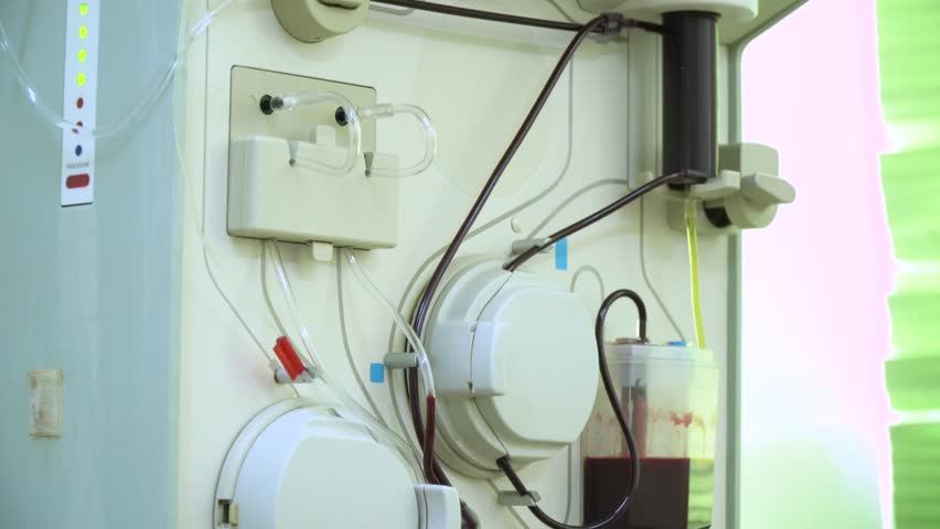 plasmapheresis cleaning patient's blood through device Stock Footage ...
