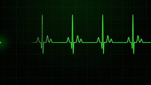 looped patient monitor displays vital signs Stock Footage Video (100% ...