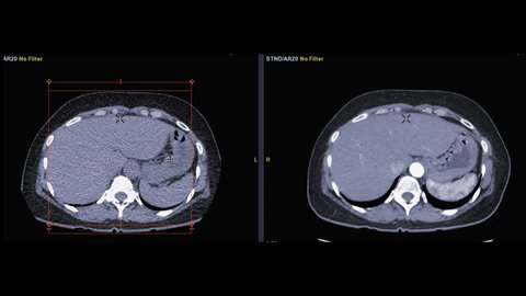 Ct scan leg Stock Video Footage - 4K and HD Video Clips | Shutterstock