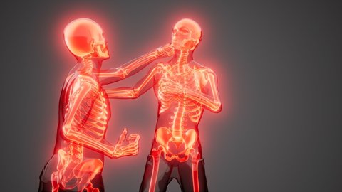 Fighting Men Visible Bones Stock Footage Video (100% Royalty-free ...