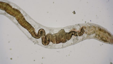 Roundworm Under Microscope 4k Stock Footage Video (100% Royalty-free ...