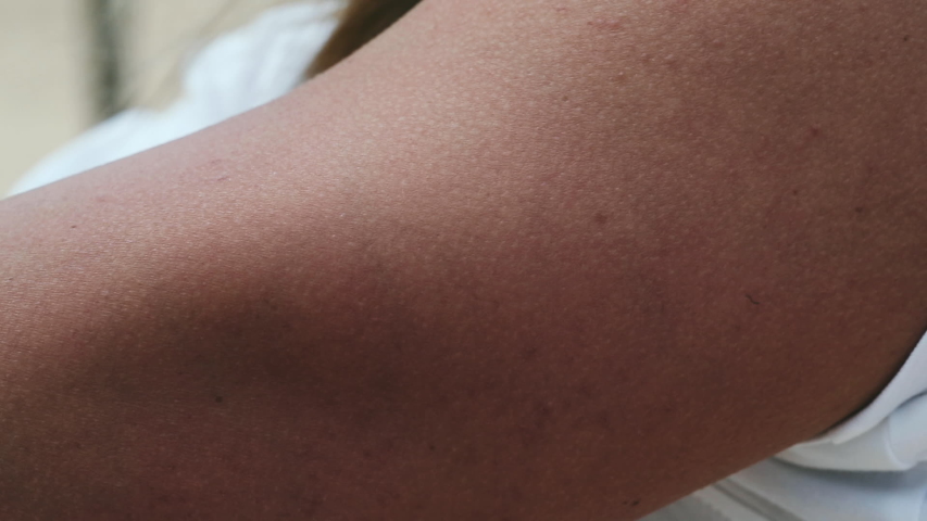 skin young woman's upper arm close Stock Footage Video (100% Royalty ...