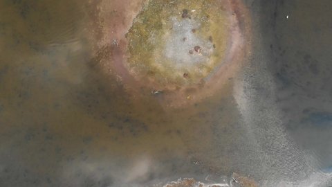 Infected Sebaceous Cyst Punctum Treatment By Stock Photo 660854581 ...