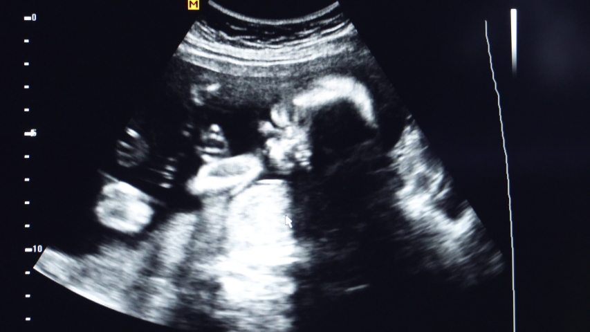 23 weeks old fetus mother's womb Stock Footage Video (100% Royalty-free ...