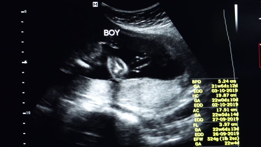 23 weeks old fetus mother's womb Stock Footage Video (100% Royalty-free ...