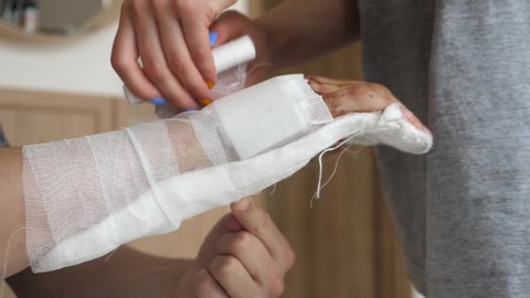 Doctor Taking Care Broken Arm Splint Stock Footage Video (100% Royalty ...