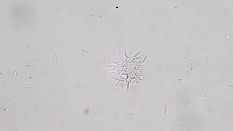 Trypanosoma Cruzi Microscope View Human Diseases Stock Footage Video ...