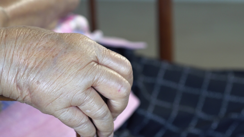 Puffy Hand Syndrome Stock Video Footage - 4K and HD Video Clips ...