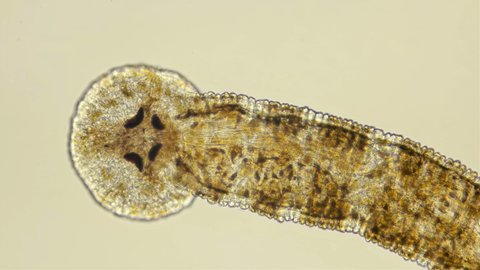 Leech Fish Leech Piscicola Under Microscope Stock Footage Video (100% ...