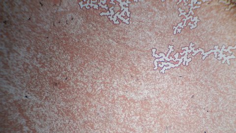 Fresh Blood Seen On 40x Microscope Stock Footage Video (100% Royalty ...