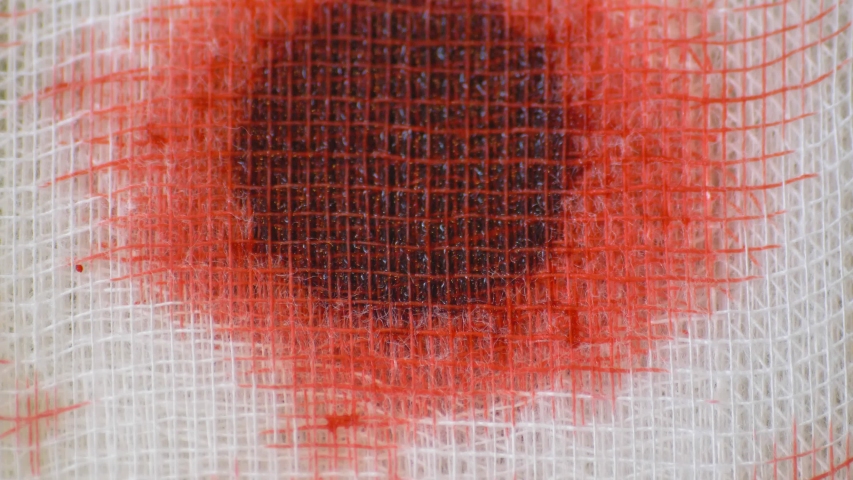 Bandages Gauze Soaked By Dripping Stock Footage Video (100% Royalty ...