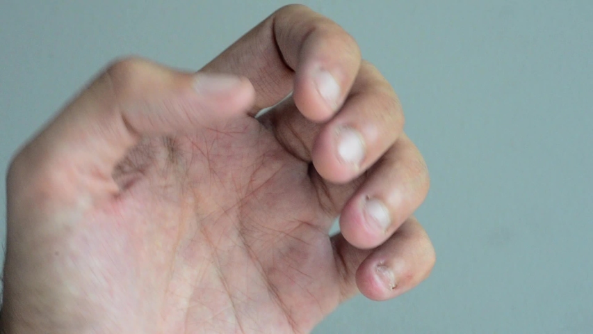 extreme close view male hand badly Stock Footage Video (100% Royalty ...