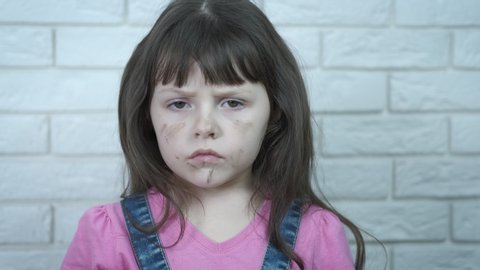 Child Abuse Sad Dirty Child Sad: video de stock (totalmente libre de ...
