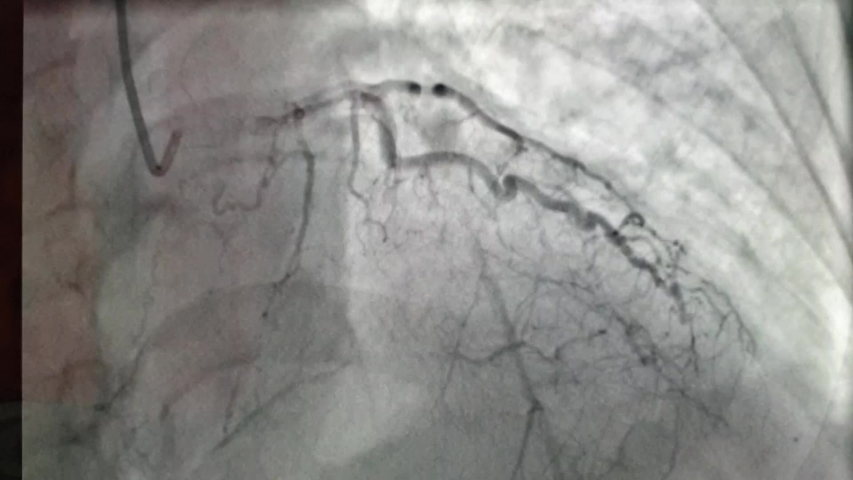 Stock Video Portfolio by CardioMan | Shutterstock