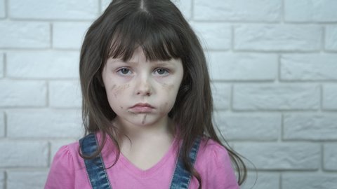 Child Abuse Sad Dirty Child Sad: video de stock (totalmente libre de ...