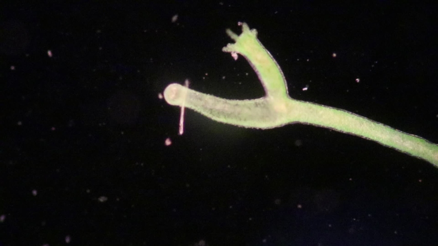 lymphonodus - cross section cut under the microscope – microscopic view ...