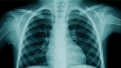 Chest Xray Scaning Animation Footage Stock Footage Video (100% Royalty ...