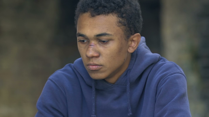 homeless injured mixed-race guy wearing hood Stock Footage Video (100% ...