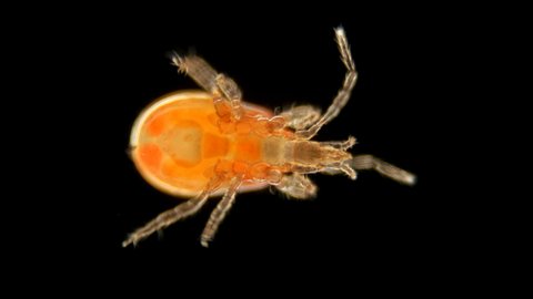 Tick Order Mesostigmata Under Microscope Class Stock Footage Video (100 ...