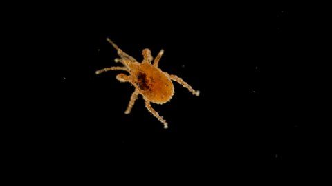 Tick Order Mesostigmata Under Microscope Class Stock Footage Video (100 ...