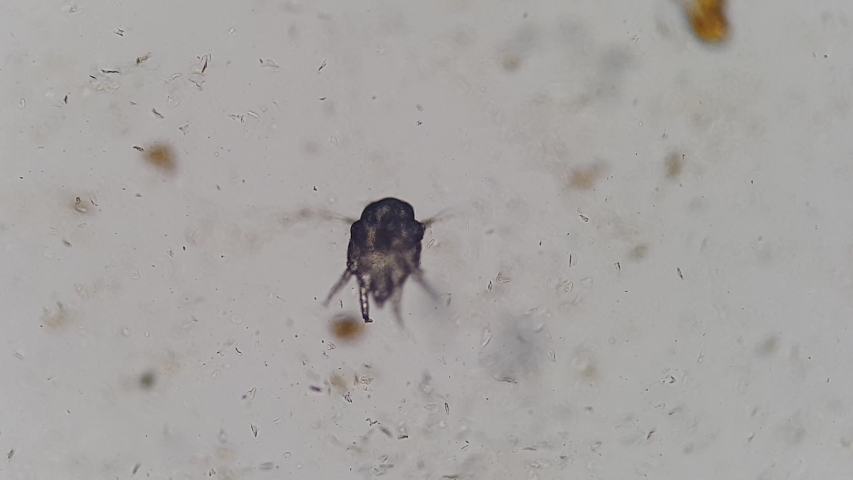 otodectes cynotis known ear scabies swab Stock Footage Video (100% ...