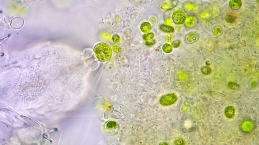 Tardigrade, Water Bear Eating. Cute Stock Footage Video (100% Royalty ...