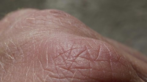 White Detailed Caucasian Human Skin On: vídeo stock (100% livre de ...